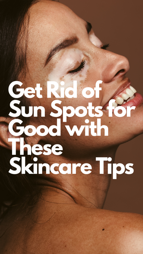 Get Rid of Sun Spots for Good with These Skincare Tips – Viegano